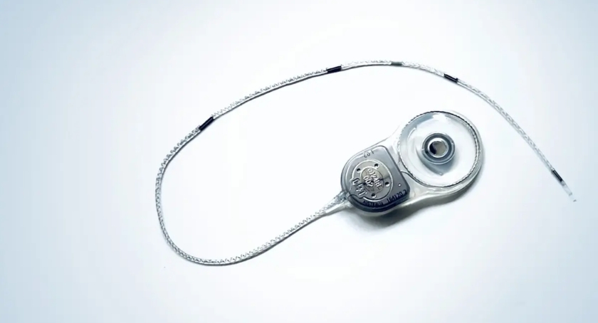 Epiminder Implantable EEG System Earns Breakthrough FDA Approval for ...